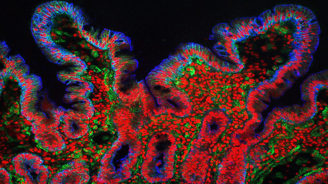 Tracing the origin of intestinal stem cells - El·lipse