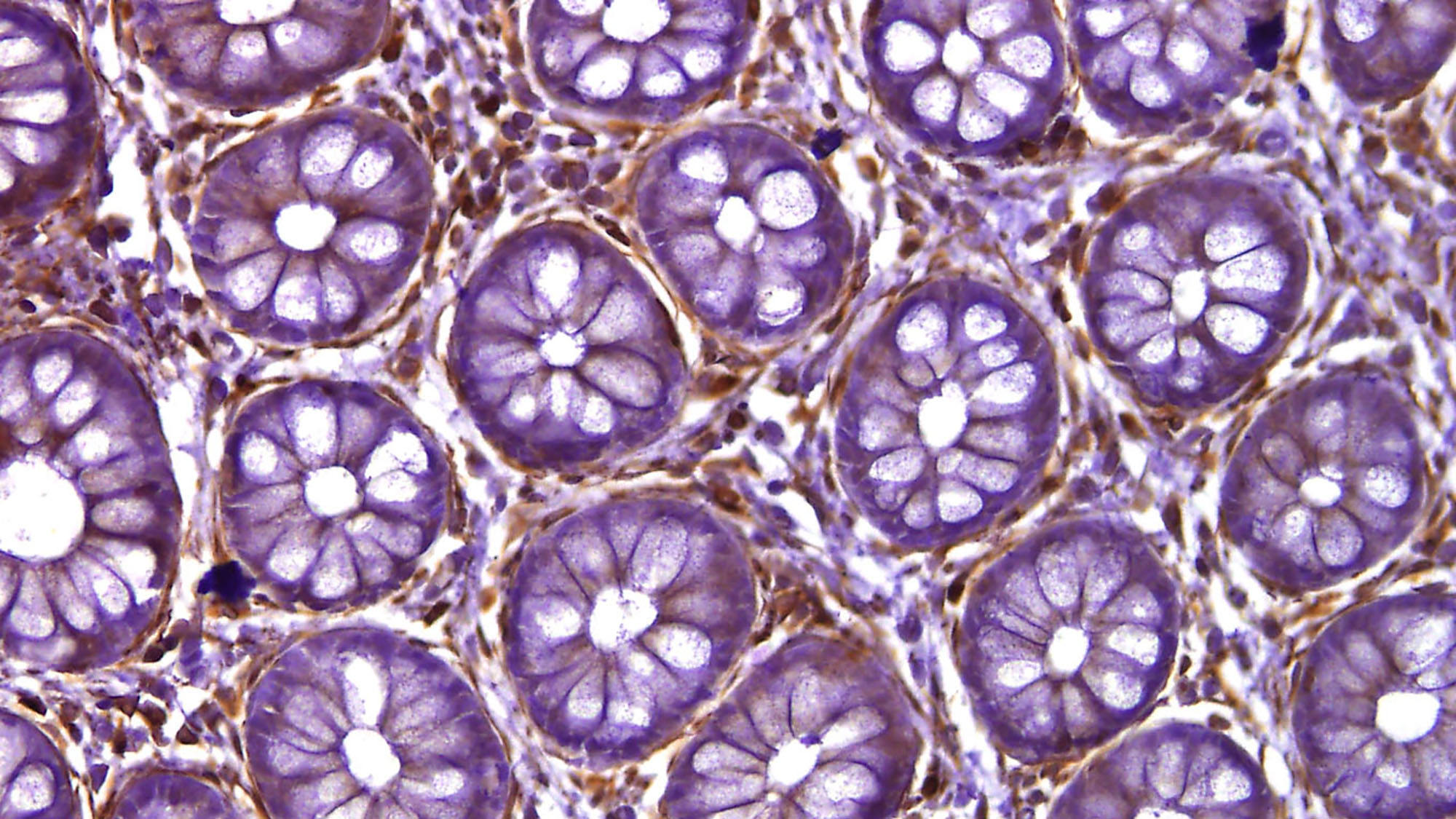 Analizando las criptas del Colon - El·lipse