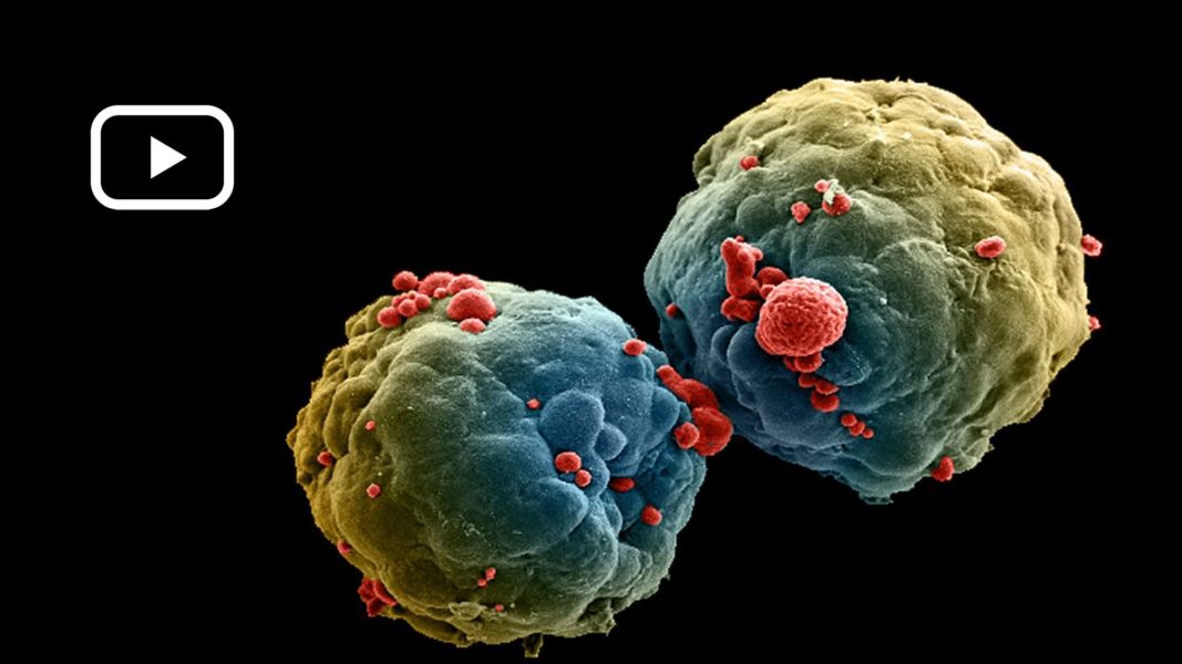 Controlar la cantidad de mucinas para tratar enfermedades respiratorias ...