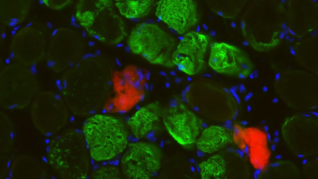 Stem-cell-independent self-repair mechanism of muscle cells - El·lipse