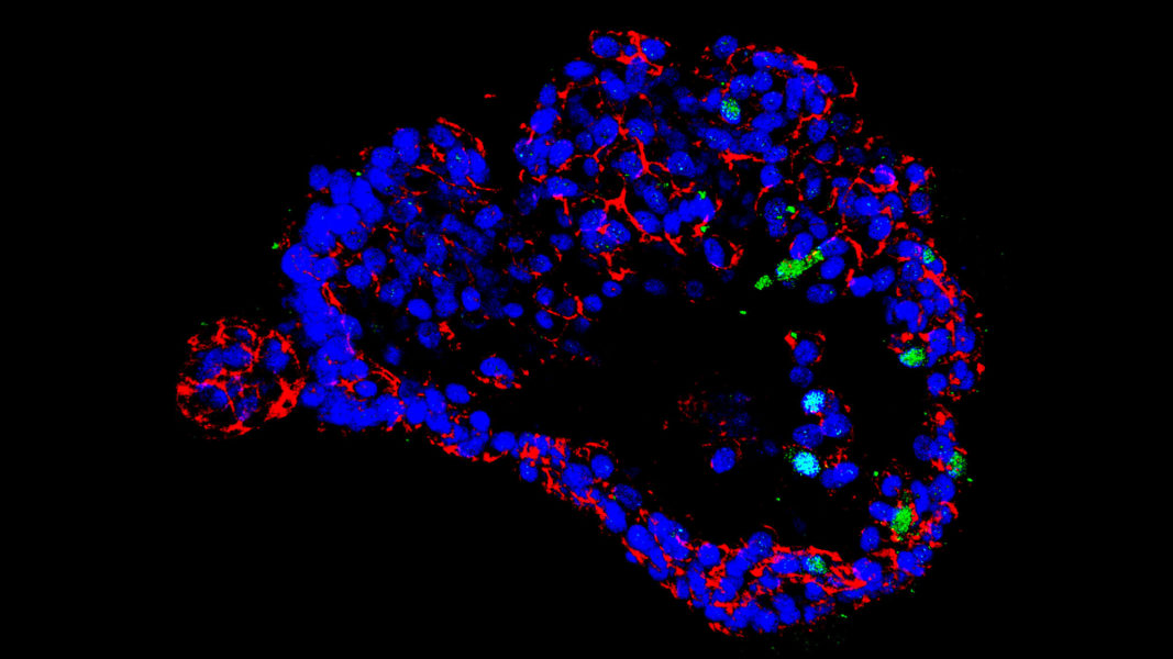 Organoids: the 3D revolution in a Petri dish - El·lipse