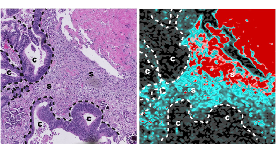 New advances in the treatment of skin, colon and rectal cancer - El·lipse